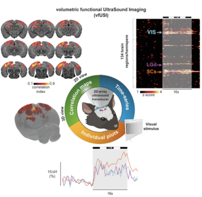 Publications – functional ultrasound imaging (fUSI)